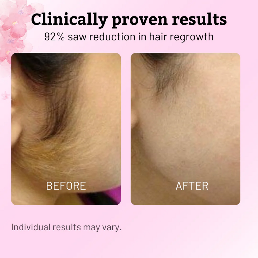 Cyperus Rotundus Oil for Hair Reduction Natural Permanent Hair Reducti ...